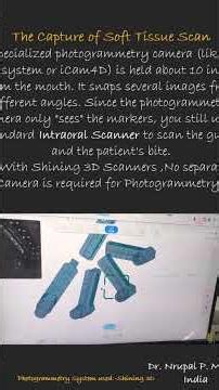 Photogrammetry -New Dimension of Digital Impressions in Dentistry #photogrammetry #dentist #implant