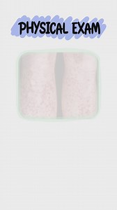 82K views · 811 reactions | Code HAVIC @medschoolbro = Mystery...