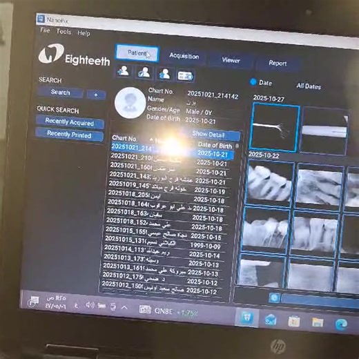 Nanopix تم ........ التحميل ✅ انطلق....🚀.... للعمل 👊 | المتخصص لصيانة معدات طب الاسنان
