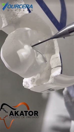 YOURCERA Dental Milling Machine Client Case