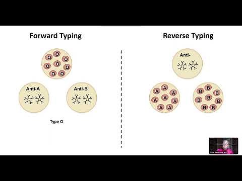 Pre-Transfusion Testing: Type, Screen, and Crossmatch