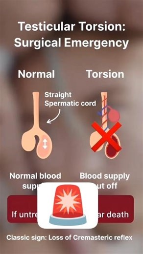 Why a testicle can die in 6 hours?🚨❗❗😱😱😱😱😱😱😱😱#viralshort #viralshorts #viral #facts #usmle #biology