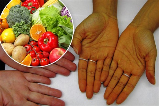 These foods can change the color of your skin if you eat too much