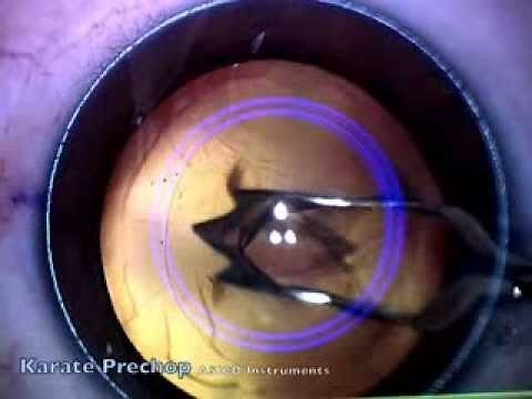 Zeiss CALLISTO EYE Lumera 700 HD SURGEON VIEW