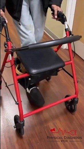 Steppage Gait from Foot Drop (Right-Sided Neuropathy)