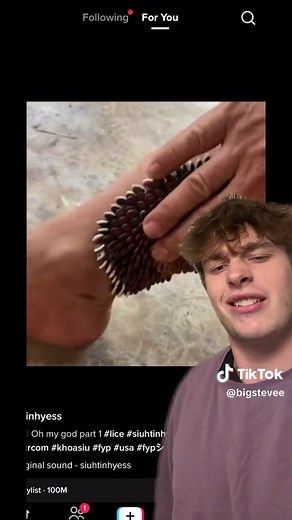 Trypophobia and Beans: Exploring the Fear of Beans