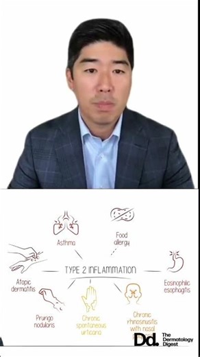 Understanding the Role of Type 2 Inflammation in Itch Across AD, Prurigo Nodularis, and CSU