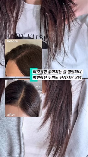 @luv_sso2 on Instagram: "#협찬 @histemo_official 요즘 샴푸해도 머릿결은 푸석, 두피는 당기고… 드라이해도 스타일 안 먹는 그 느낌 🥲 그래서 써본 게 히스테모 울트라스칼프케어 뉴트리셔너 두피랑 모발을 같이 케어해주는 제품이라 괜히 기대됐는데 제형부터 촉촉 + 끈적임 없어서 합격👌 바르자마자 두피는 시원~하게 진정되고 머릿결은 바로 윤기 살아나는 느낌이라 요즘 드라이할 때 손맛이 달라요… 며칠 써보니까 ✔️ 머릿결 덜 엉키고 ✔️ 윤기랑 탄력 살아나고 ✔️ 두피도 훨씬 편안 두피 따로, 모발 따로 케어하기 귀찮은 분들 이거 진짜 데일리로 쓰기 좋음 👍 #히스테모 #두피케어 #모발케어 #영양공급 #솔직후기 #리얼리뷰 #히스테모추천 #인생템 #꿀템발견 #이거진짜 #두피모발케어 #뷰티스타그램 #헤어케어 #데일리케어"