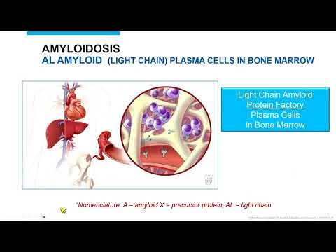 Cardiac Amyloidosis | Mayo Clinic Echo 2024