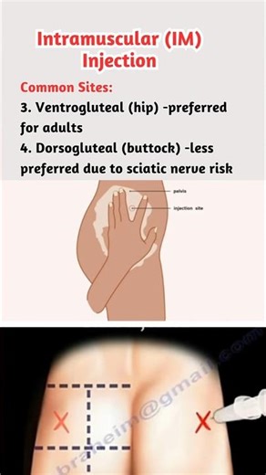 Intramuscular Injection #InjectionPractice #HealthcareEducation