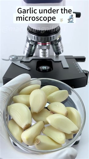 Amazing Garlic Microscopy at 400X Magnification