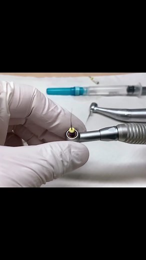 #rootcanalfiles #rootcanalsupplier #rootcanalretreatment #endodontics #endodontic #dental #dentalhygienist #dentalstudent #dentalassistant #dentalschool #dentalhygiene #dentaloffice #dentalist #dentist #fyp #fypシ #foryoupage