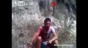 Man Hand Almost Cut Into Half By Machete