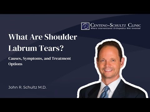 What Are Shoulder Labrum Tears? And What Are The Causes, Symptoms, and Treatment Options