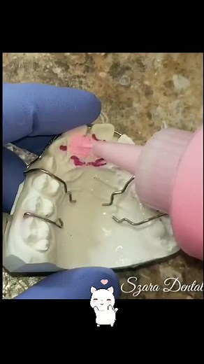 Cotton Candy Pink Retainer | ASMR Orthodontic Video