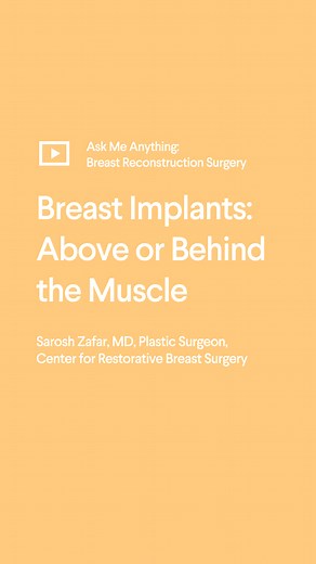 77 reactions | Implant placement is a very personal decision, and understanding your options can help you feel more confident about your breast reconstruction surgery. Check the comments for more info. #BreastReconstruction #Breastsurgery #Implants #BreastCancerSurgery #BreastCancerSurvivor #PlasticSurgery #BreastCancerWarrior #breastcancersurvivors #breastcancersupport | Breastcancer.org | Facebook