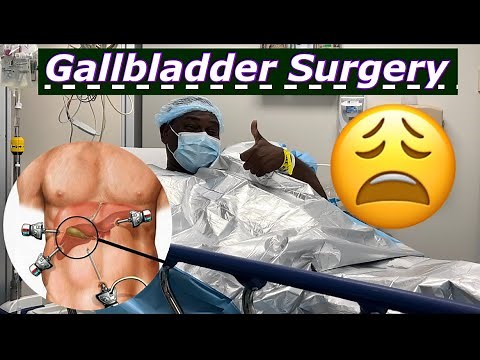 Gallbladder Removal Surgery / Cholecystectomy / Gallstones