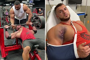Bodybuilder shares update after horrendous torn pectoral muscle benching 220kg