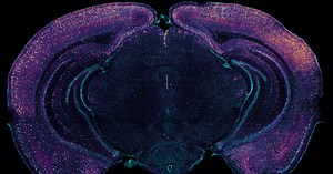 How sensory gamma rhythm stimulation clears amyloid in Alzheimer’s mice