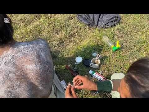 Full Back Hair Removal Transformation 😮 | Satisfying Close-Up ASMR (4K)