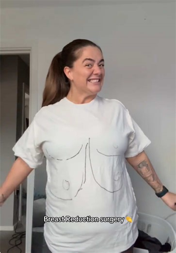 Breast Reduction Transformations That Inspire Awe