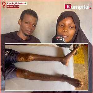 961K views · 11K reactions | No comment. Faites parler vos cœurs. À suivre jusqu’à la fin. Cagnotte  https://www.cotizup.com/ibrahima-sory-diallo , Orange Money ‪+224 625 01 07 71‬ / +224 625 61 42 12. Wave / Orange Money  : +221 77 701 47 76 PayPal  https://www.paypal.com/donate/?hosted_button_id=ZDU5NBSF92Q46 | KUMPITAL | Facebook