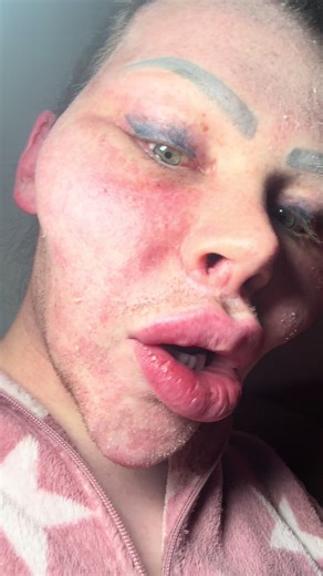 Die Haut schält sich schon 🫶💁‍♀️ #foryoupage❤️❤️ #ForYouPage #goviral #fyp #beauty