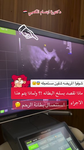 4K views · 29 reactions | #دكتورة_ابتسام_الكعبي #سلخ_البطانه...