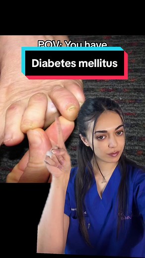 Common Skin Disorders in Diabetic Patients