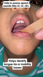 Oral Motor Exercise: Tongue Elevation Check with Tongue Depressor Description: In This video a tongue depressor is used to evaluate tongue elevation. It is commonly used in speech therapy sessions to check oral muscle tone, mobility, and strength—especially beneficial for children with speech delays, drooling, or feeding difficulties. ✅ Purpose of Using a Tongue Depressor Under the Tongue: 1. Check Tongue Elevation Ability Helps assess how well the child can lift the tongue upward, a key movemen