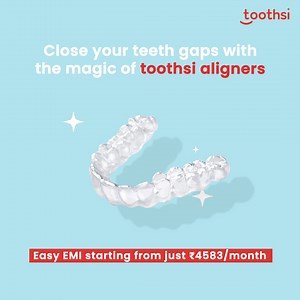 The time to flaunt that picture perfect smile is NOW. Get your hands on toothsi aligners, book your scan today. | toothsi by makeO