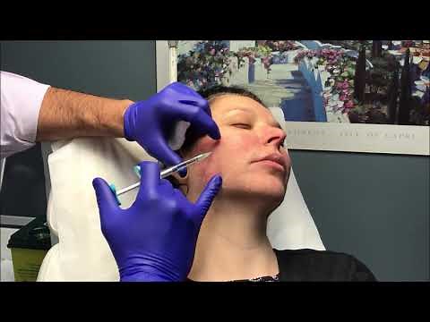 Dr. Nino Kuzmar Injects Juvederm Volite SKIN BOOSTER