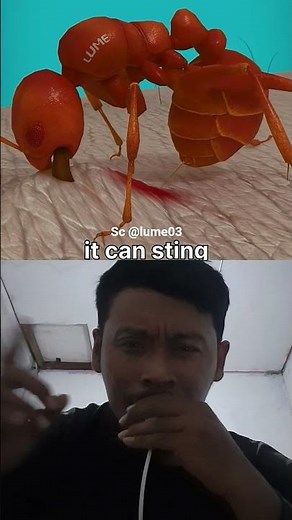 This Is What Happens When a Poisonous Ant Bites You! 🐜 | Crazy Science Experiment