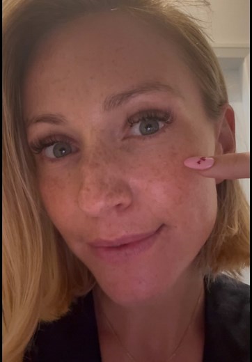 Counting Freckles ASMR: A Soothing Experience