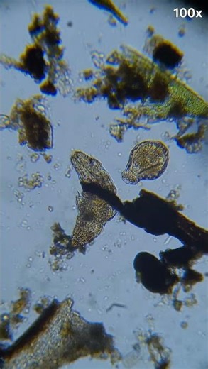 I Dried This Tardigrade For 2 Weeks — It’s Still Alive! #microscope