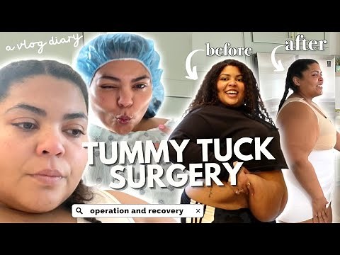I FINALLY GOT MY PLUS SIZE TUMMY TUCK SURGERY & BRA LINE BACK LIFT VLOG | ps. DR. REPTA IS THE GOAT
