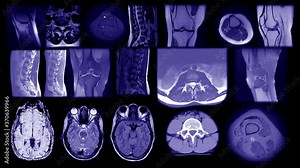 MRI scans set multi screen, human brain, head, body, bones, spine and organs. Animated stop motion mosaic of various body parts CT scan or x ray. Pulsation anatomy seamless loop.