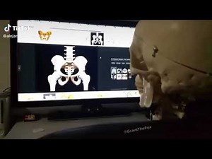 Skeleton nuts on computer