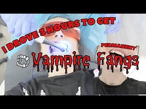GETTING PERMANENT VAMPIRE FANGS