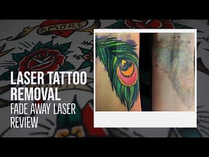 Laser Tattoo Removal Before and After Pictures