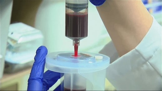 Doctors offer pain-free solution with PRP therapy in Cincinnati