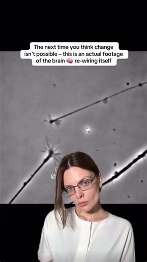What change looks like in the brain: actual footage of the brain re-wiring itself