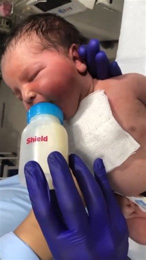 Watch how a 4.9 kg IDM (Infant of Diabetic Mother) baby was severely crying due to hunger and how feeding and gentle NICU care brought him comfort and calmness. This video shows the importance of timely feeding, baby cues, and post-feed satisfaction in newborn care. 👶 In this video you’ll see: Hungry crying signs in newborns Feeding management for large IDM babies How to calm and comfort a crying baby after feeding NICU nurse care and baby handling techniques Disclaimer: This video is for educa