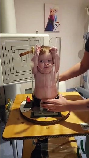 How Babies get an X Ray
