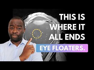 Eye Floater Adaptation SECRETS Revealed