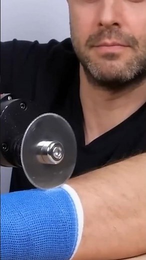 പ്ലാസ്റ്റർ മുറിക്കുന്ന മെഷീൻ തൊലി മുറിക്കാത്തത് എന്തുകൊണ്ട്? 🤔 The Science of Cast Saw