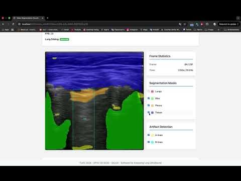 Vylepšenie aplikácie pre detekciu príznakov v sonografii pľúc