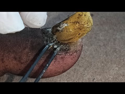 Trimming Smelly Toenails: How to Clean and Freshen Up Your Feet!