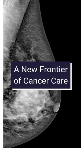 “If we have a really tiny cancer like a single cell, we might be able to kill it.” The potential of alpha-emitters as a new frontier of cancer care is huge. Though both alpha and beta emitters have been used to target and treat many types of cancers, the increased power and accuracy of alpha-emitters is making a big impact, especially on how we treat aggressive cancers. In this video, Geoff Johnson, MD, PhD explains more about alpha emitters and how nuclear medicine works to target and treat can