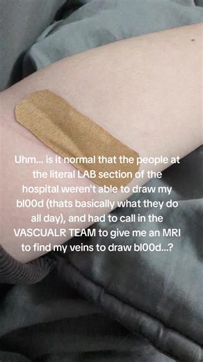 Anyway, hurt like hell, they also did 1 on each hand, 2 on my left arm, and one on my right arm, I hate needles 🥰 #vein #blood #hospital #story #real